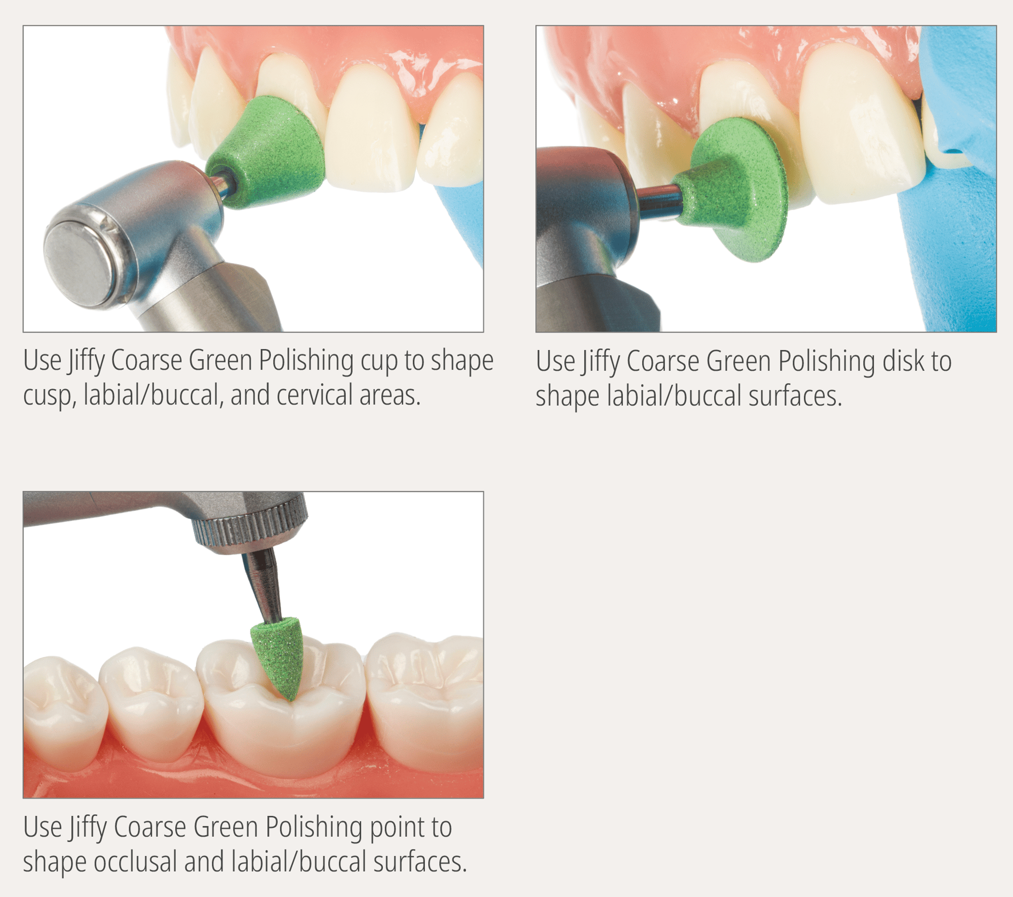 Clinical Guide: Jiffy™ Composite Finishing Systems