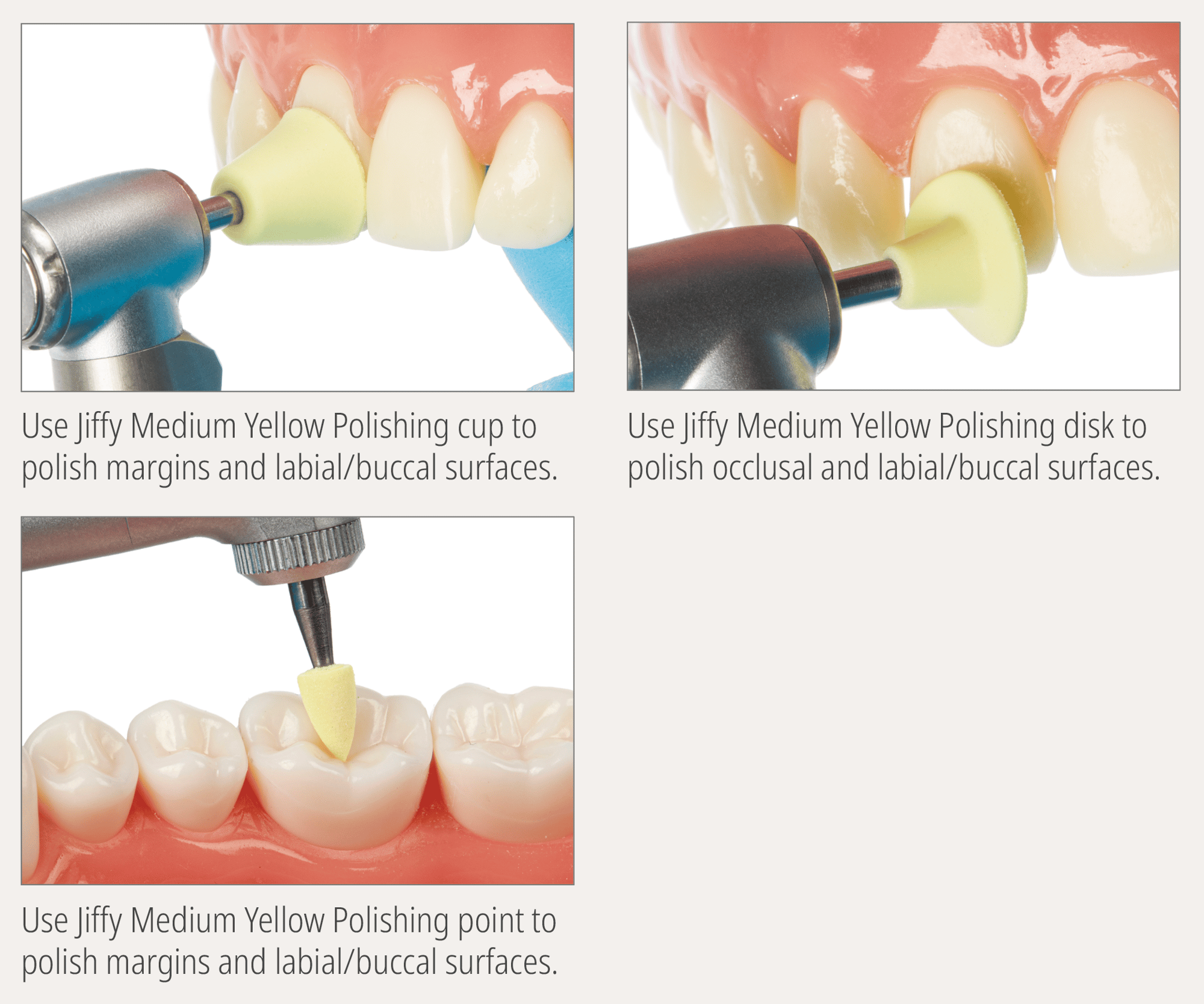 Clinical Guide: Jiffy™ Composite Finishing Systems