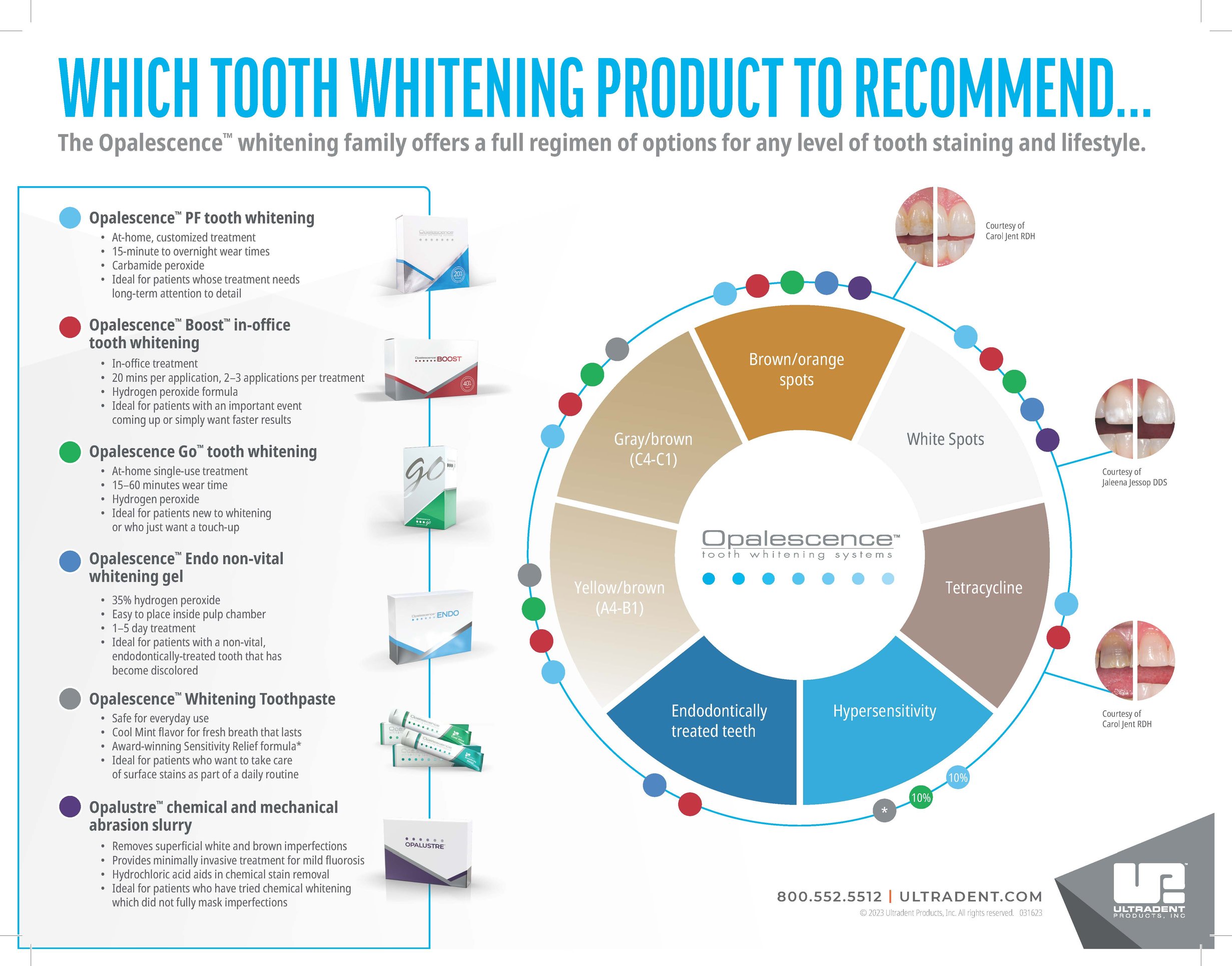Understanding the Causes Behind Teeth Staining