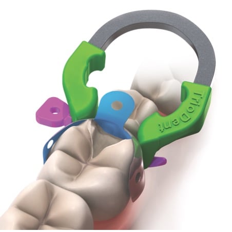 Circumferential Vs. Sectional Matrix Bands
