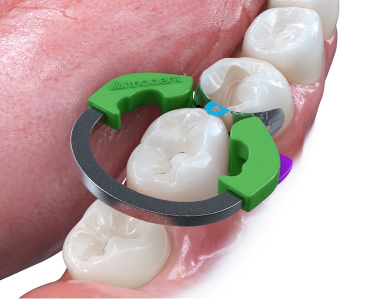 Circumferential Vs. Sectional Matrix Bands